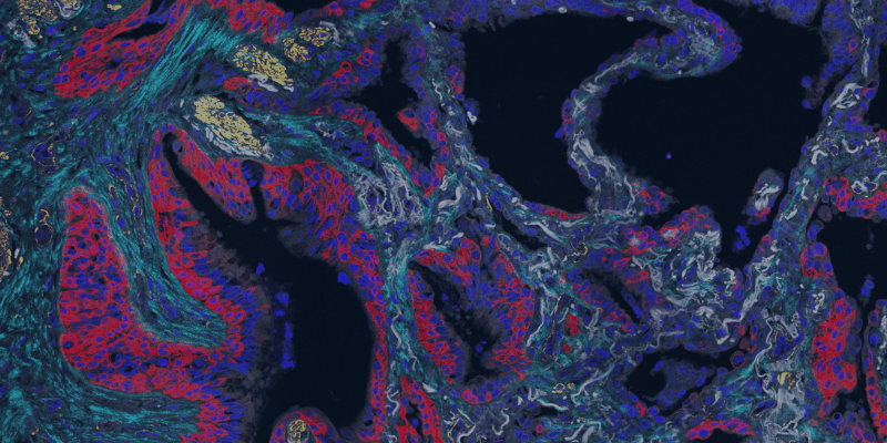 M&M 2025 (Microscopy & Microanalysis)